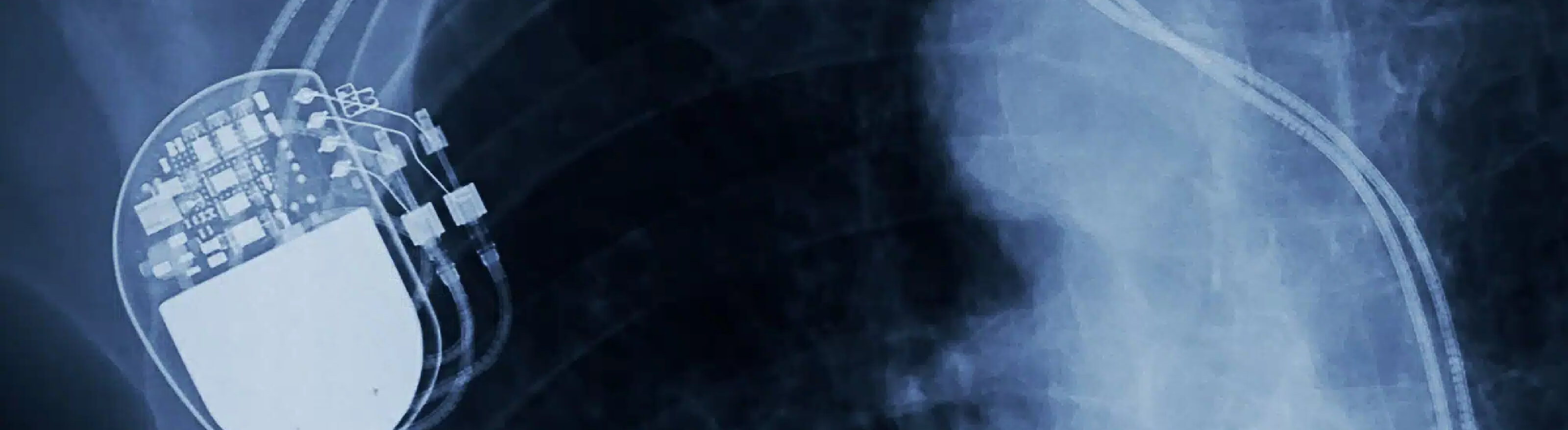 Defective Medical Devices - Baker, Burton & Lundy